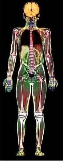 6 Advantages of undergoing a full-body MRI scan