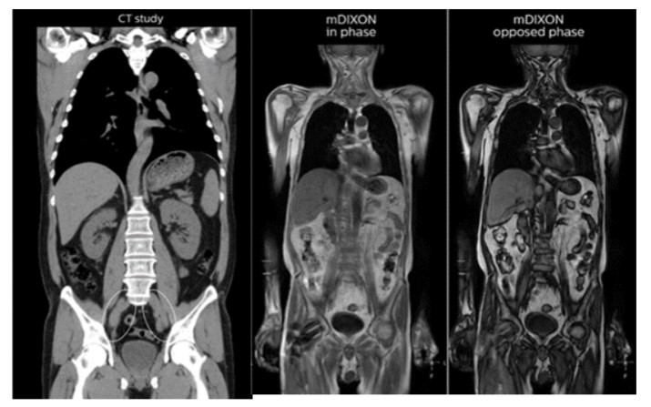 6 Advantages of undergoing a full-body MRI scan