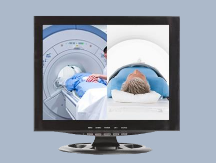 How MRI compatible cameras help detect real-time motion