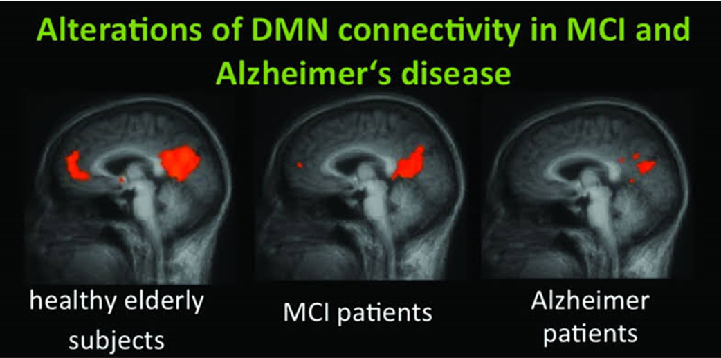 Monitor brain activity using functional magnetic resonance imaging