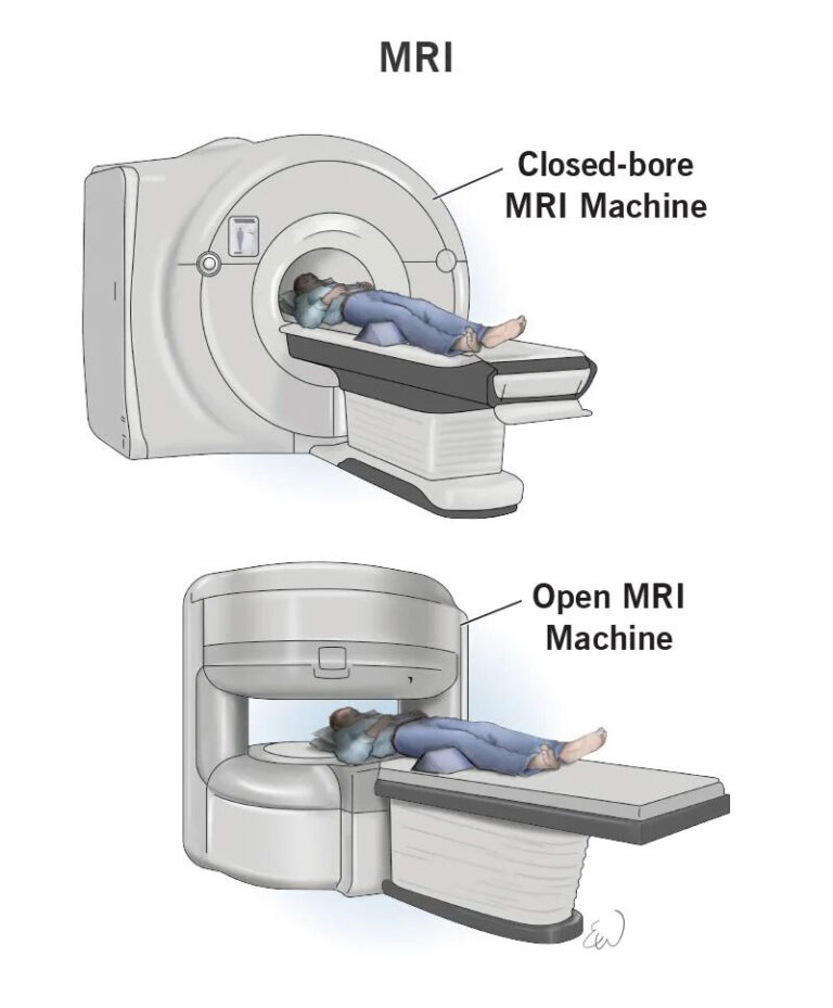 Find how technology has improved the MRI experience then and now