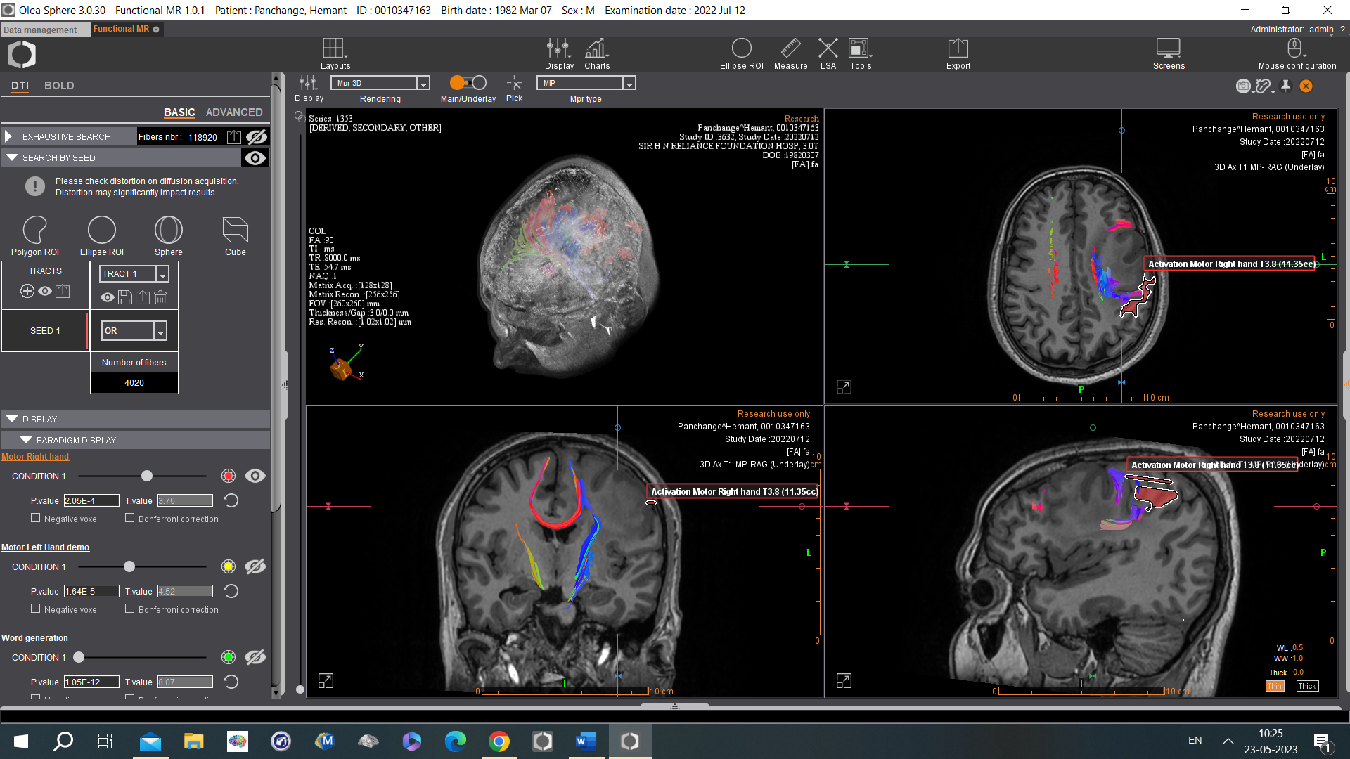 How Neuroscience Research has been revolutionized by fMRI