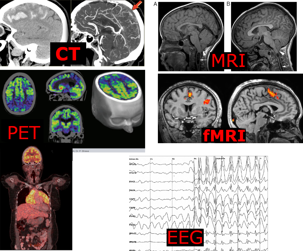 How FMRI aids in Diagnosing and Treating Mental Health Disorders